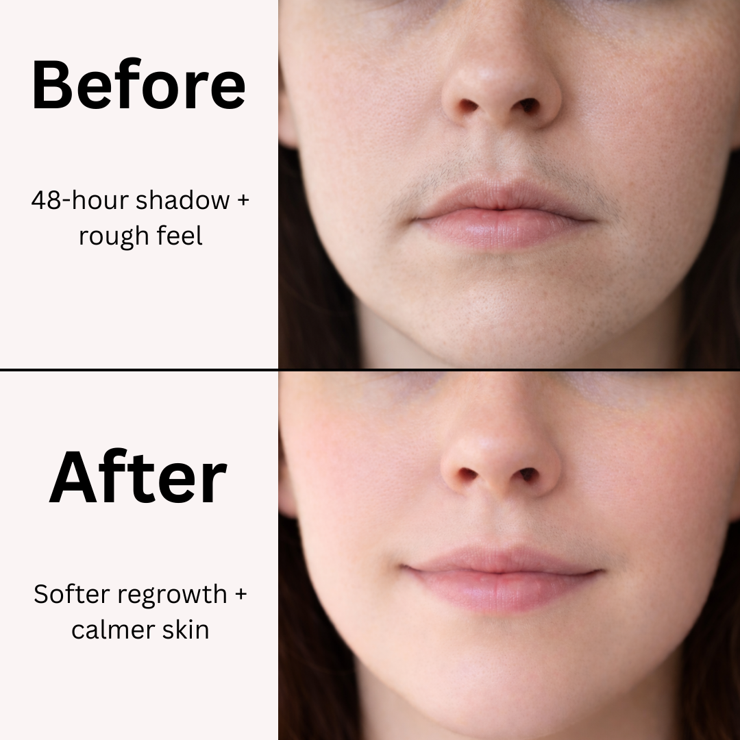 ORAINO Hair Regrowth Inhibitor Serum with Cyperus Oil